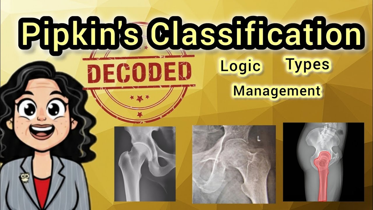 Pipkin's Classification Decoded . Logic Types & Management - YouTube