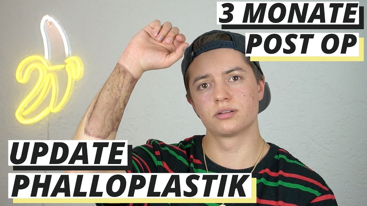 Ich habe Gefühl im Penoid! - Phalloplastik 3 Monate post Op - ftm ...