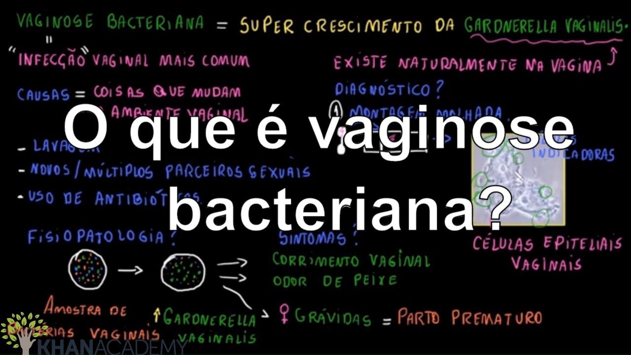 O que é vaginose bacteriana? | Vida e evolução | Khan Academy - YouTube