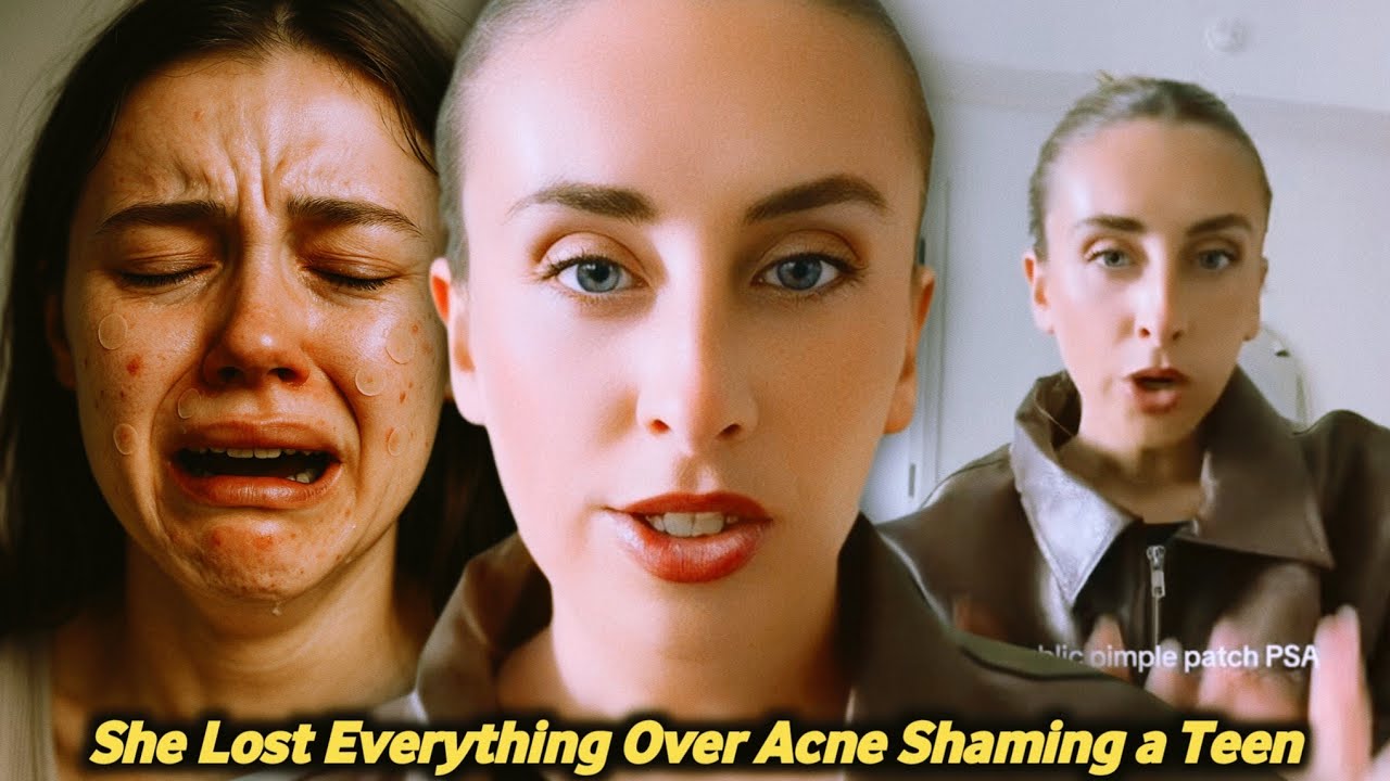 TikTok Beauty Influencer Bullied a Teen Over Acne—Now It’s Backfiring ...