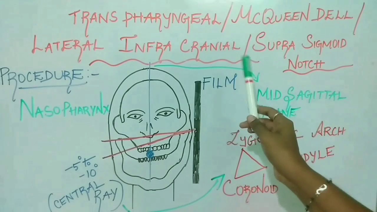 TRANSPHARYNGEAL VIEW#Learn in 5minutes - YouTube
