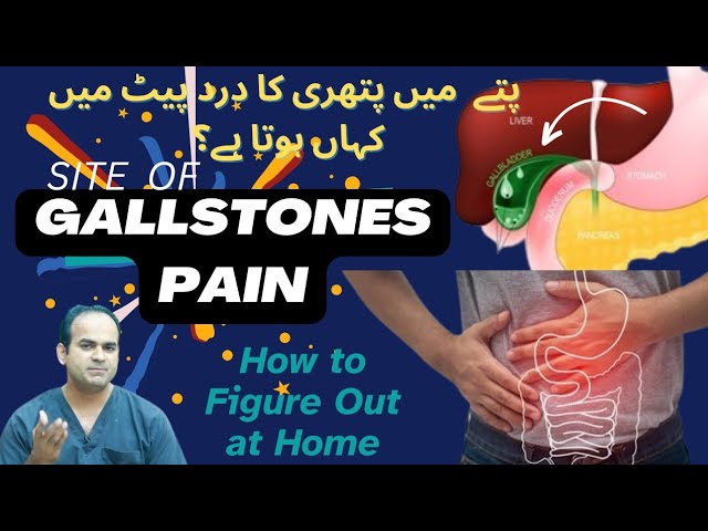 Gall Stone Pain Am I Having A Gallbladder Attack | WakeMed