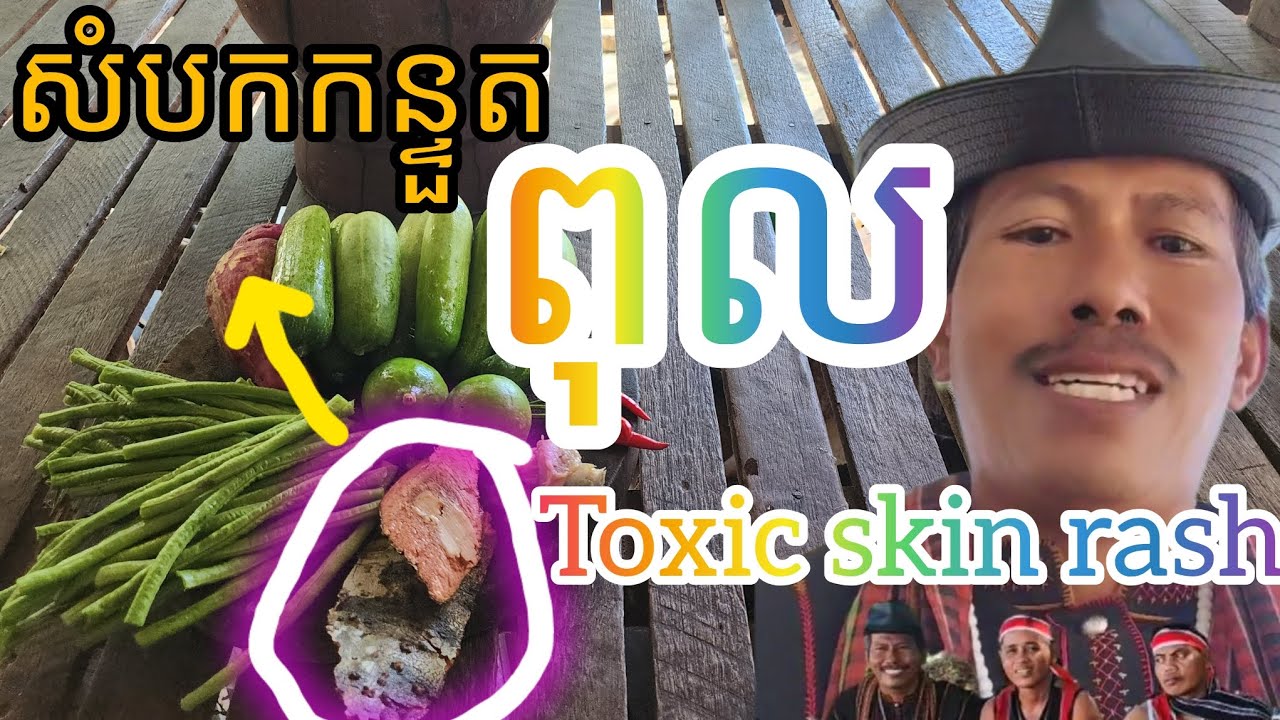 ពុលសំបកកន្ទួត//Toxic skin rash? - YouTube
