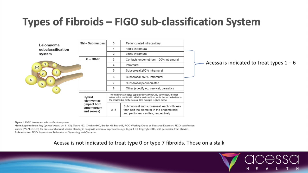 Fibroid Pathology - YouTube