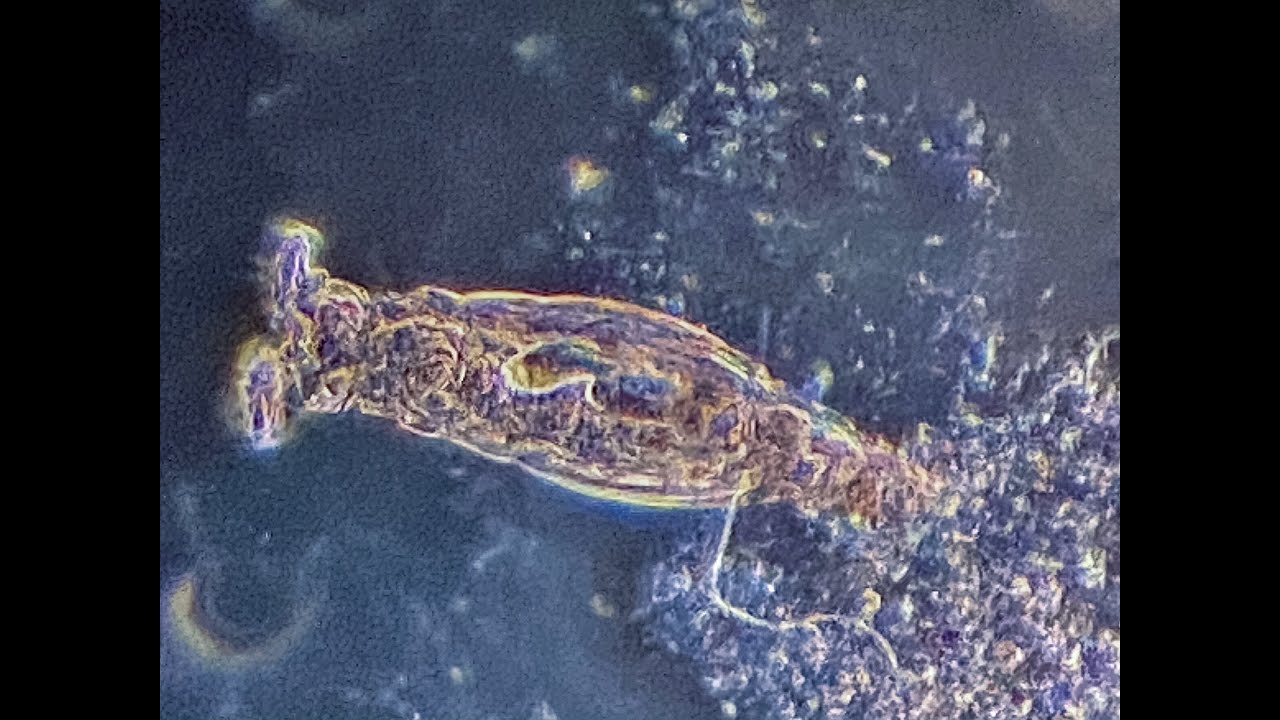 Microscopy - The Rotifer - YouTube