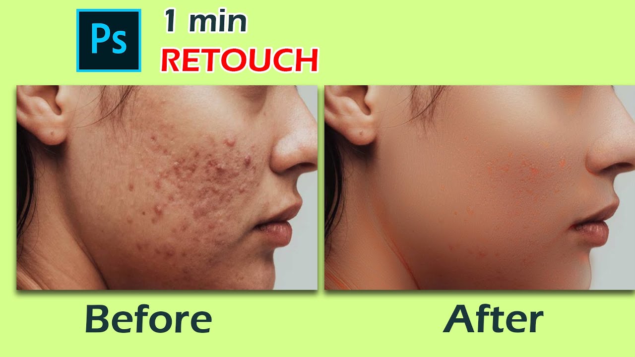 Easy way to pimple remove in photoshop - YouTube