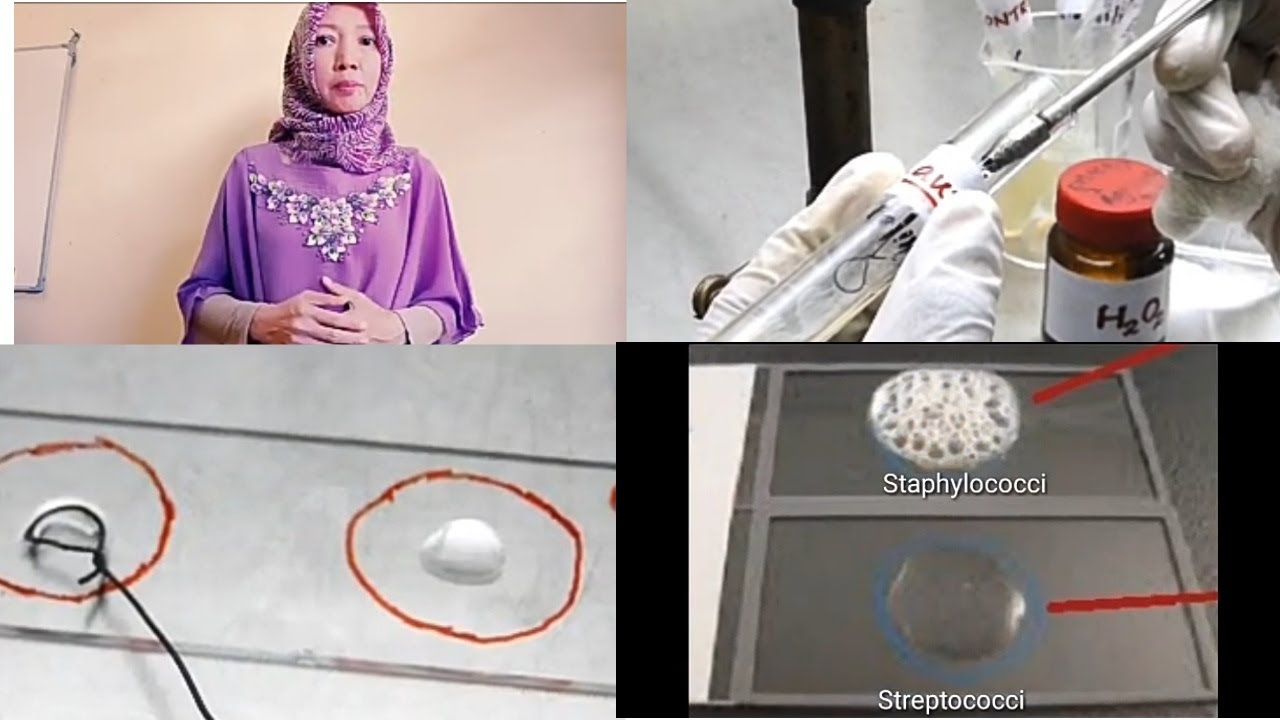 PRAKTIKUM MIKROBIOLOGI 6 || Uji Katalase || Ilmu Kedokteran Dasar || S1 ...