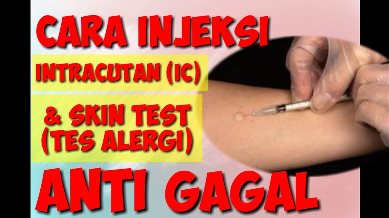 Cara injeksi Intracutan dan cara mengaplus obat untuk skin test - YouTube
