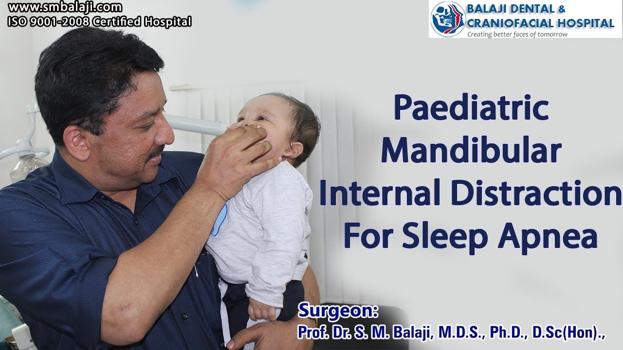 PAEDIATRIC MANDIBULAR INTERNAL DISTRACTION FOR SLEEP APNOEA - YouTube