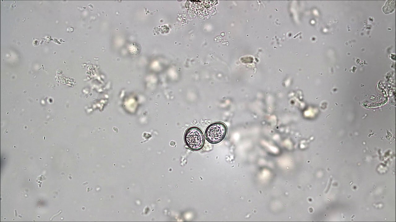 Isospora canis (Canine coccidiosis) - YouTube