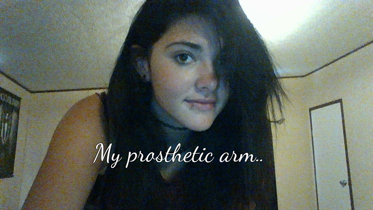 My Prosthetic Arm - YouTube