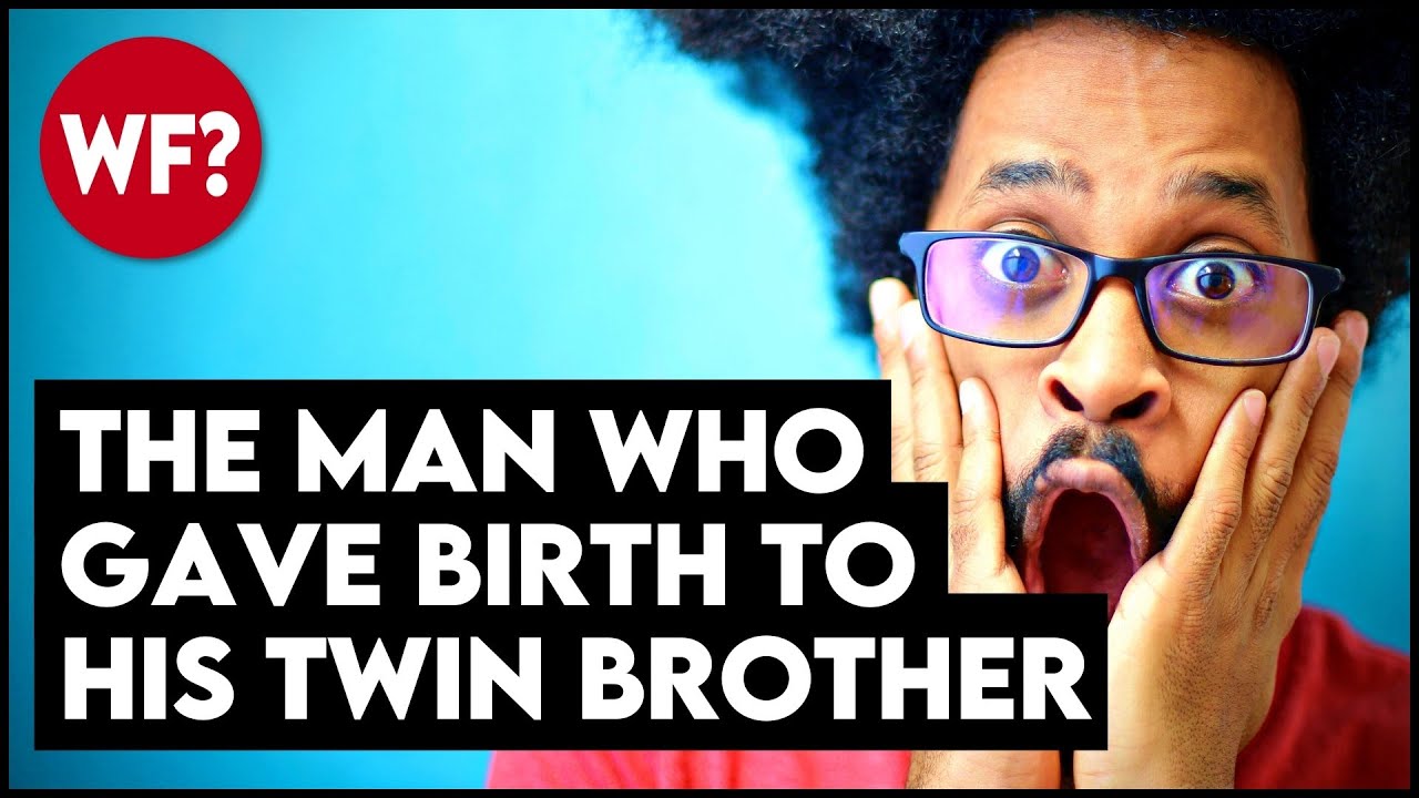The Man Who Gave Birth -- To His TWIN - YouTube