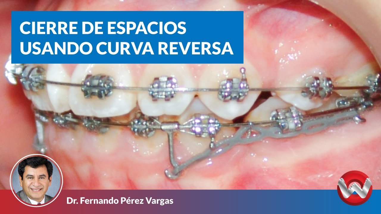 Curva Reversa De Hollenback - LIBRAIN