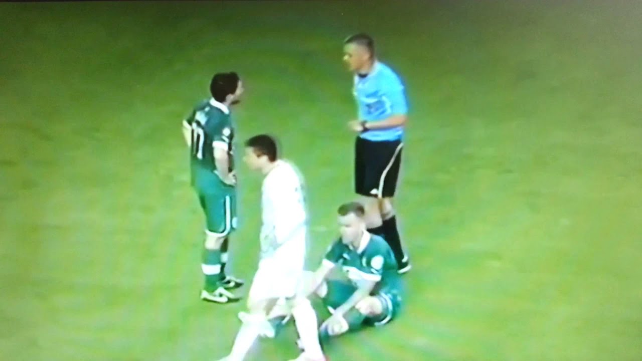 Open fracture of the leg football zlomena noha otevrena zlomenina nohy ...
