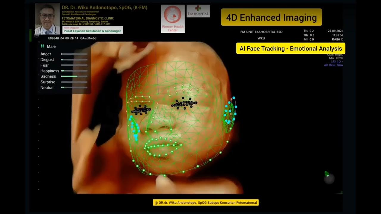 4D AI Integrated Emotional Facial Tracking Ultrasound - YouTube