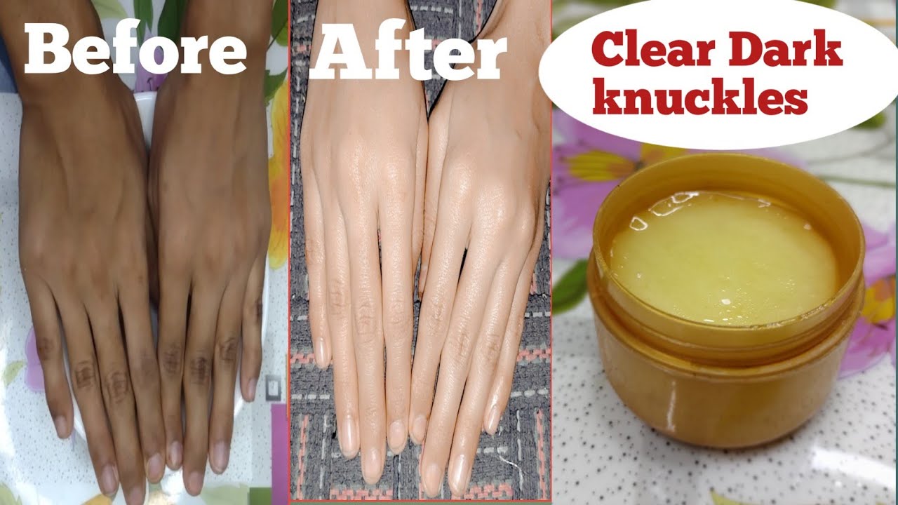 Do This Every Night only 7 days To Lighten Dark knuckles and Brighten ...