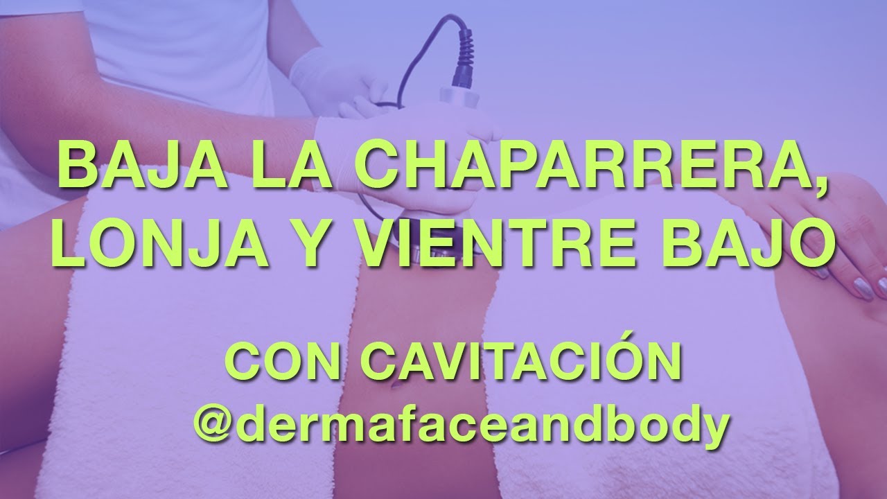 Cómo bajar chaparreras, vientre bajo y lonja con Tratamiento Cavitación ...