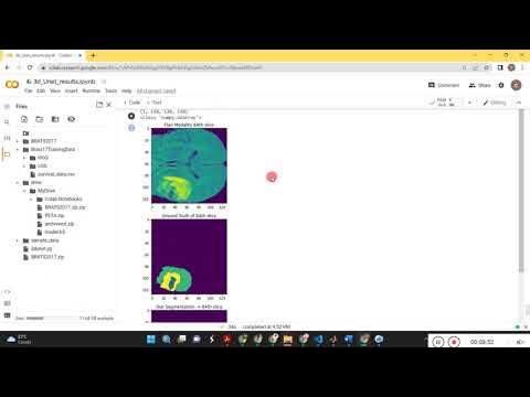 3D-Unet model for Brain tumor segmentation - Brats Dataset -Python - YouTube