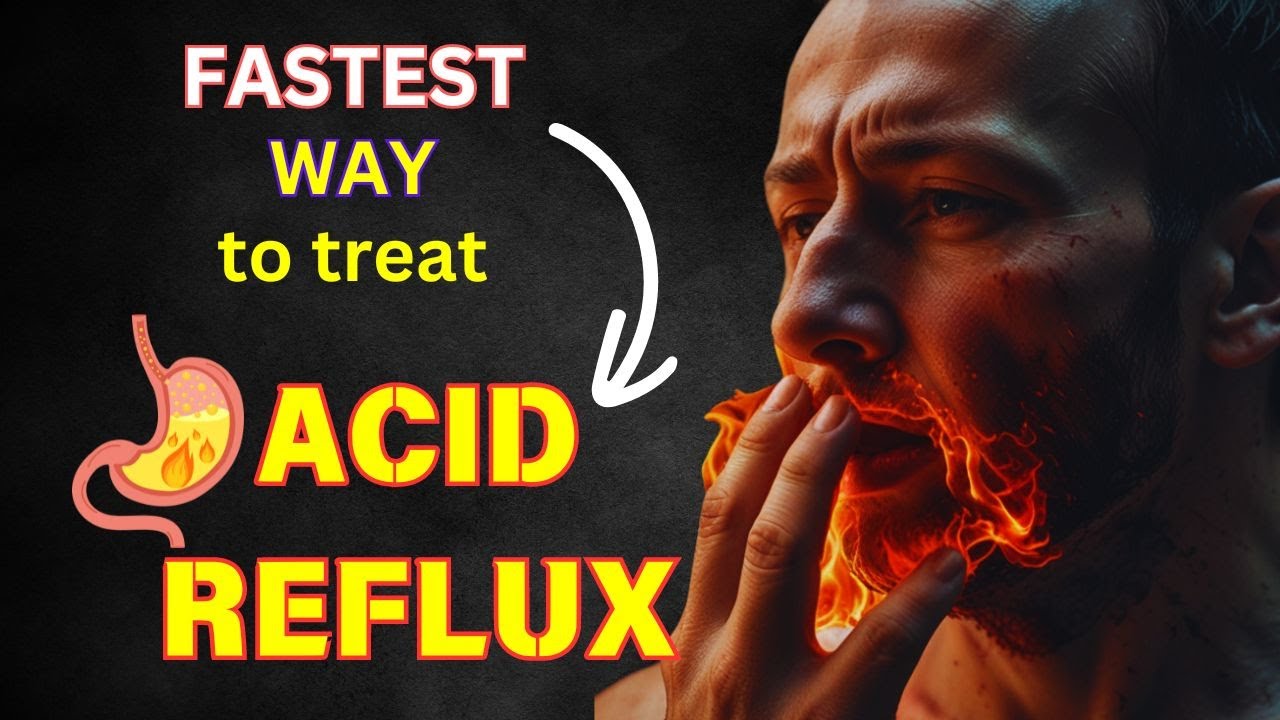 How To Get Rid Of Acid Reflux at Home | Treat Acid Reflux Naturally ...