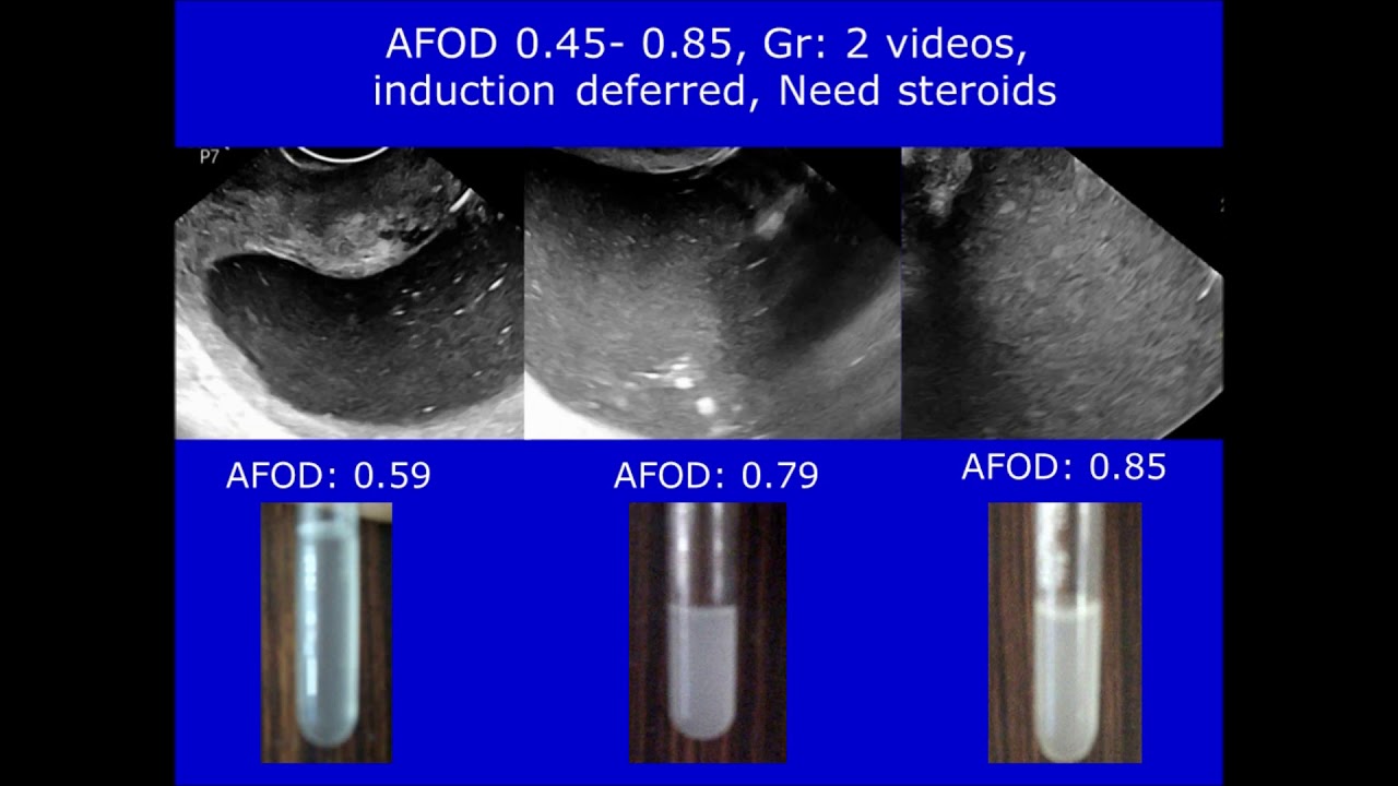 Fore-water imaging by TV Sonography, Grade 2 video picture - YouTube