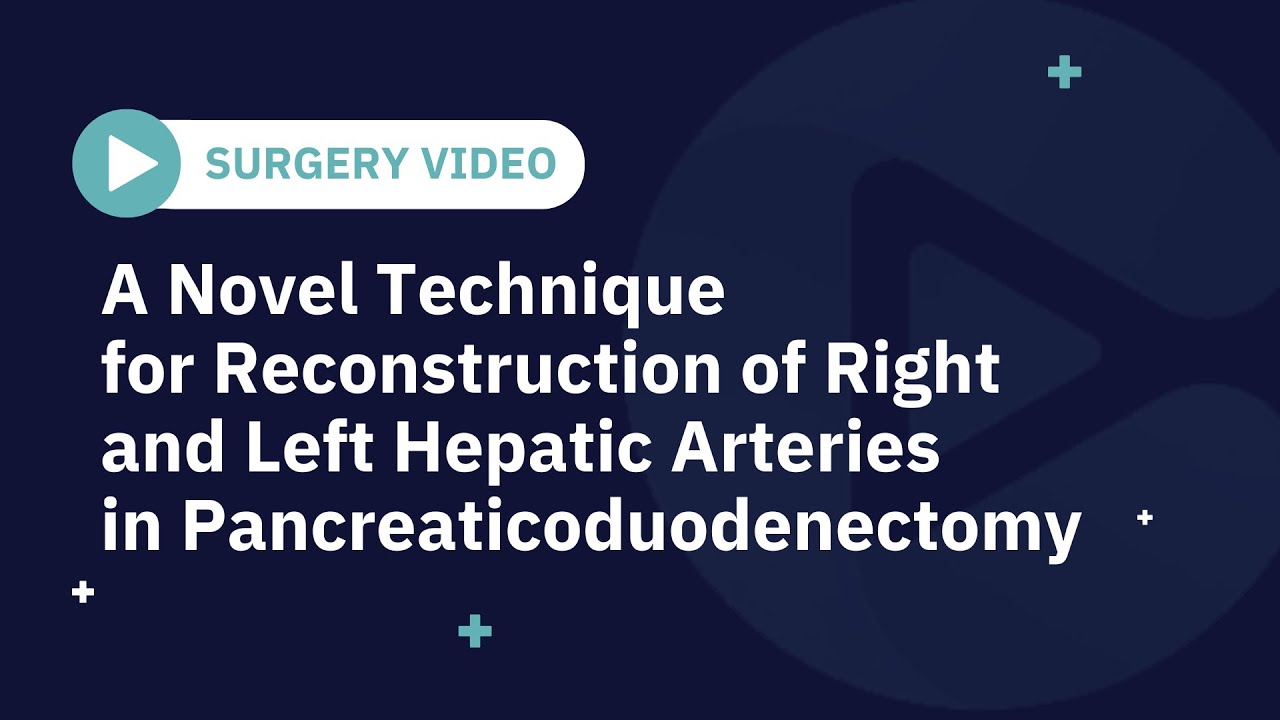 Surgery Video: A Novel Technique for Reconstruction of Right and Left ...