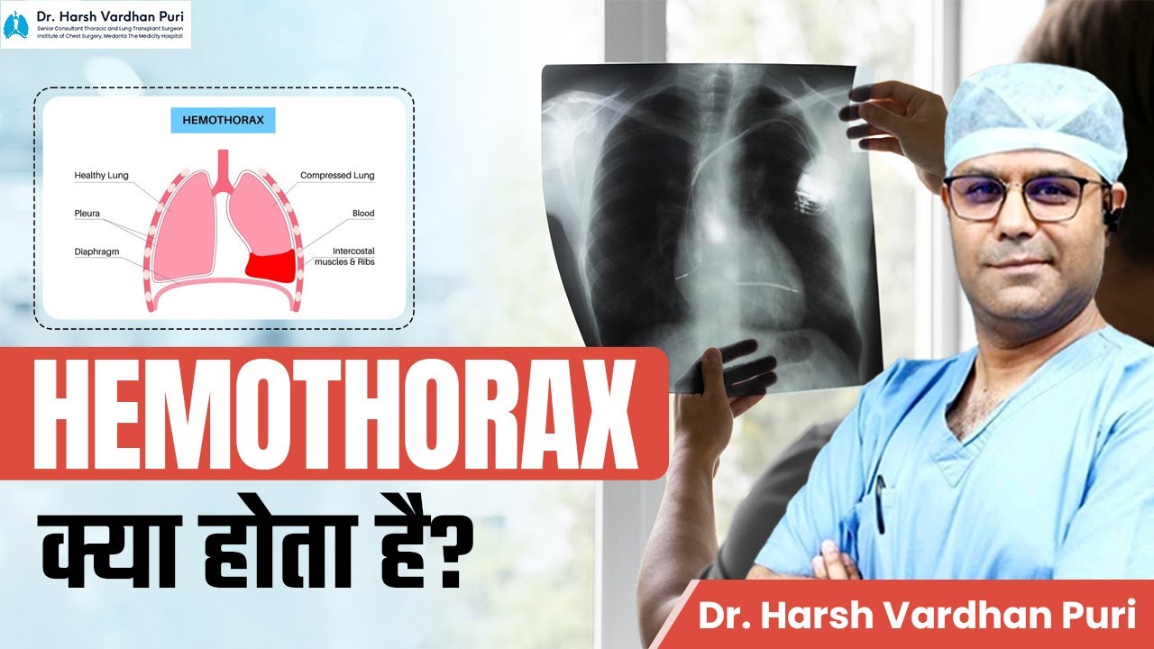 Hemothorax क्या होता है? 🚨 Hemothorax Causes Symptoms & Treatment by Dr ...