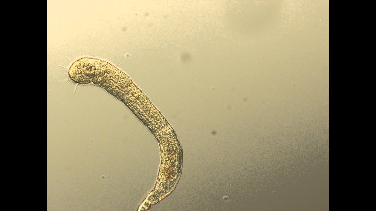 Gnathostomula sp 10x - YouTube