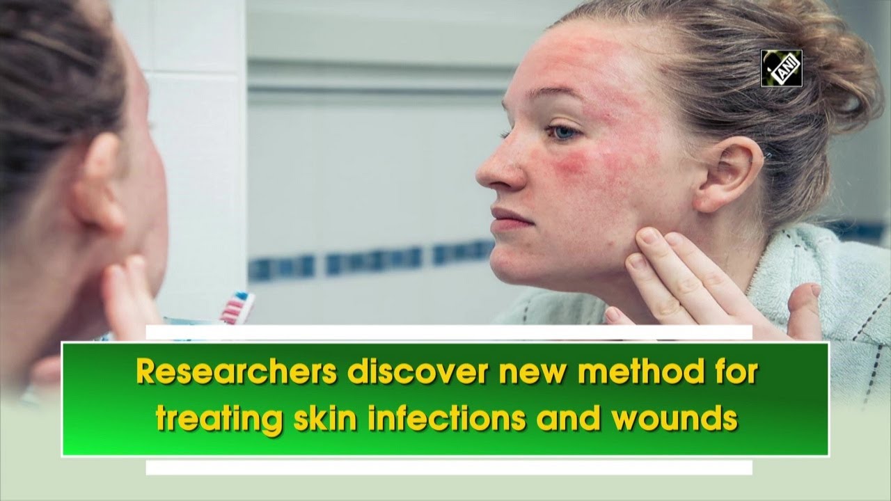 Researchers discover new method for treating skin infections and wounds ...