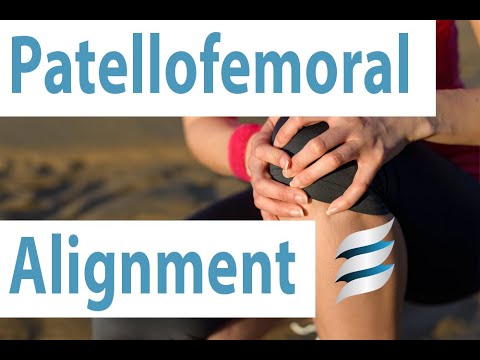 How can I improve my patella tracking? - YouTube