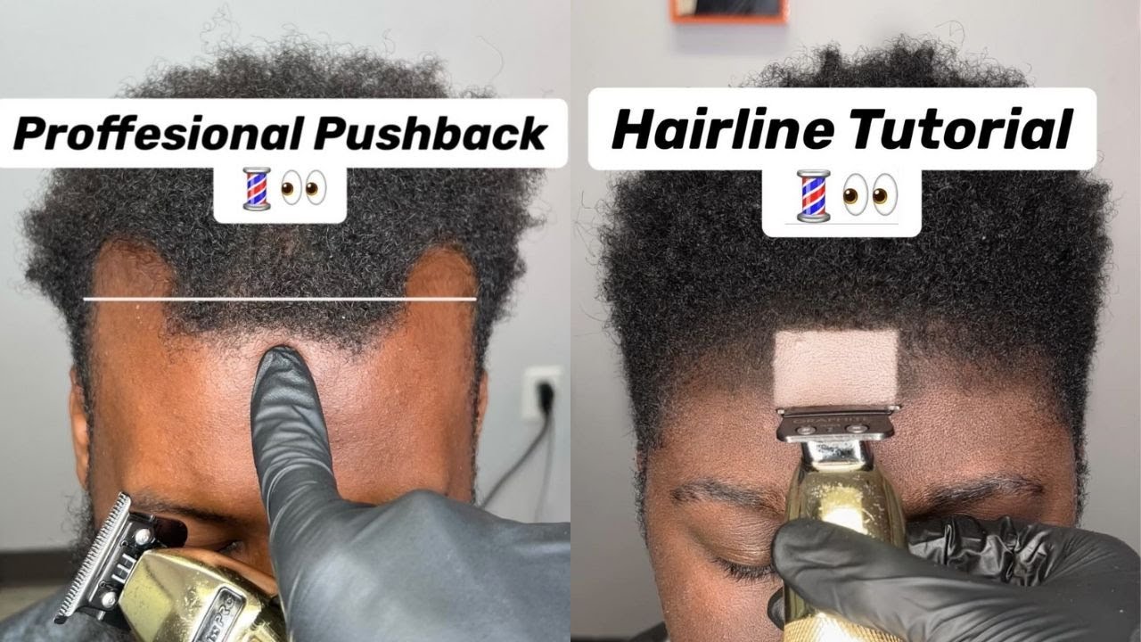 Craziest Hairline up Fixing Compilation ️ Hairline Fixed 💈 - YouTube