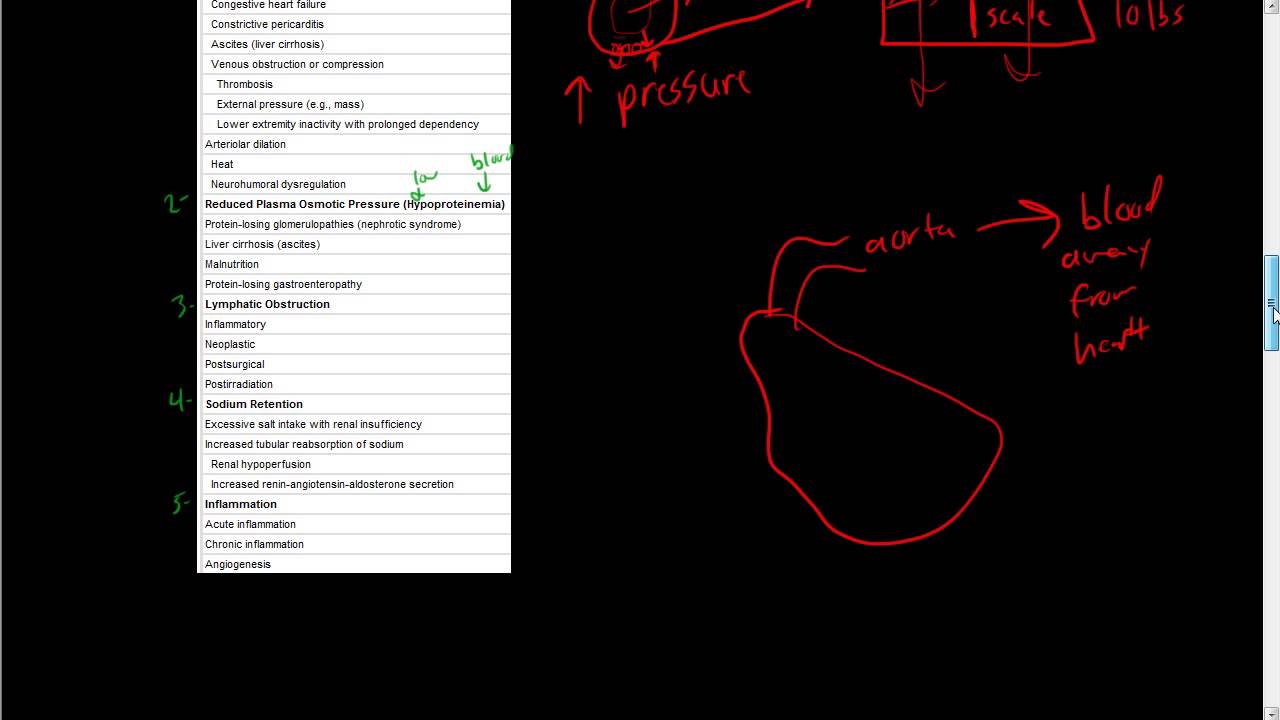 #42-Hemodynamic Disorders-Edema-Increased Hydrostatic Pressure - YouTube