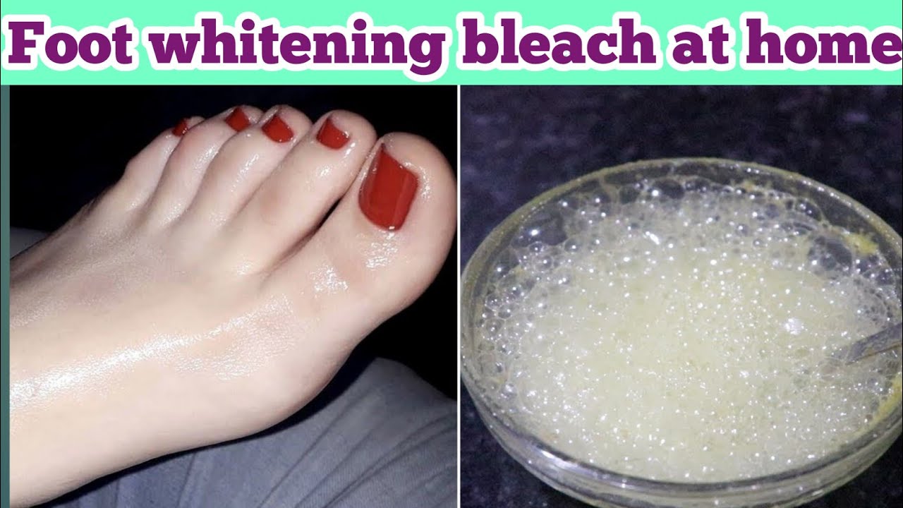 Foot whitening bleach |How to make hand and feet white home remedies ...