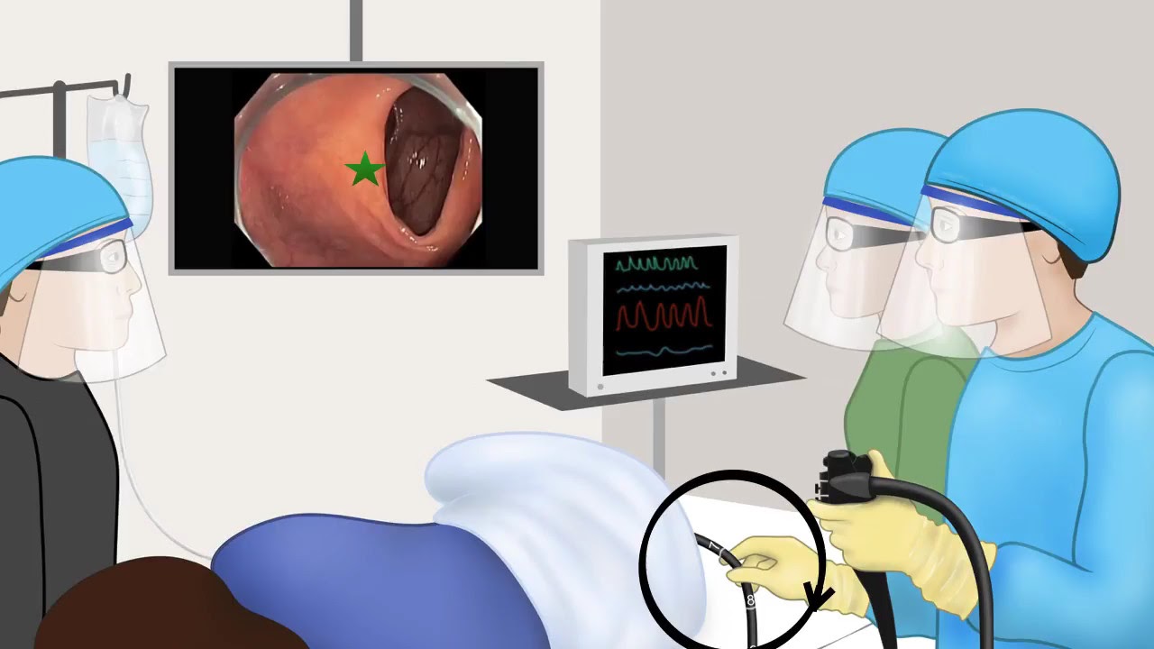Colonoscopy: EMR Tip - Short Scope Critical for EMR - YouTube
