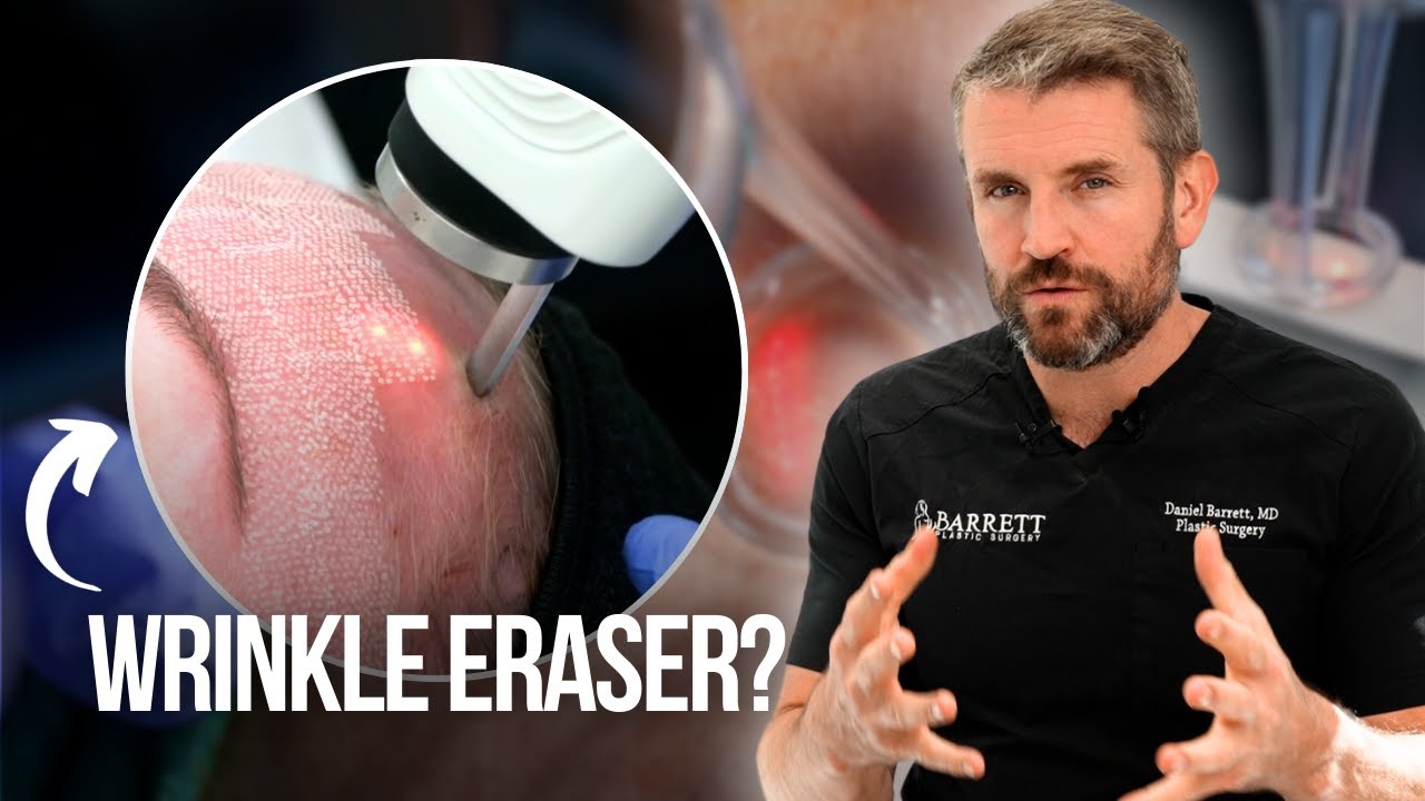 Why CO2 Laser Is the Ultimate Skin Fix! - YouTube