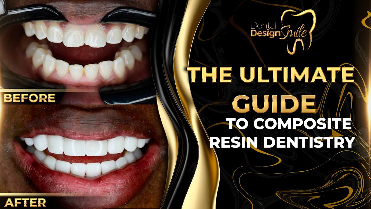 The Ultimate Guide to Composite Resin Dentistry - YouTube