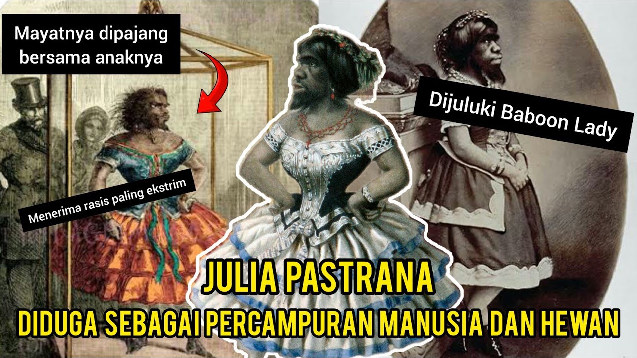 BABOON LADY:) WAJAHNYA PENUH RAMBUT, MAYATNYA DIPAMERKAN DI SELURUH ...