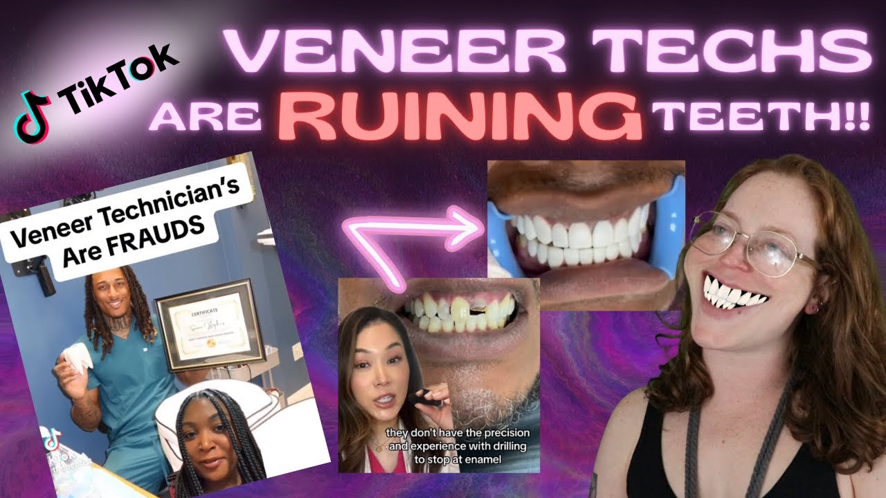 This is ILLEGAL! Do NOT go to a VENEER TECH - YouTube