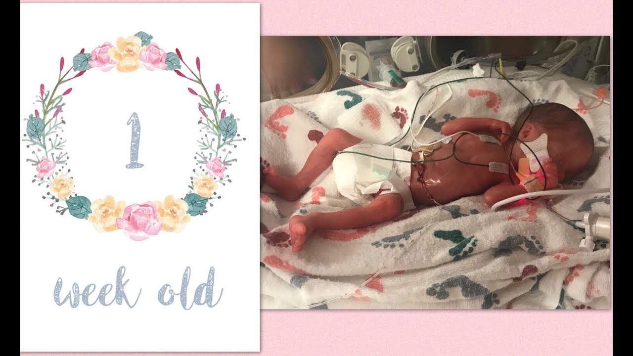 1 Week NICU Update 👶🏼 - YouTube