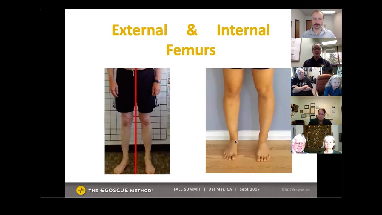 Fix your knee pain by fixing your posture - YouTube