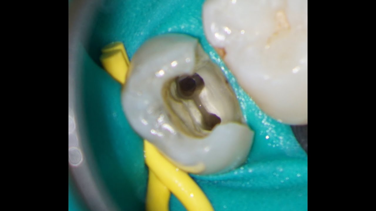 UR5 3 canals & fractured file - YouTube