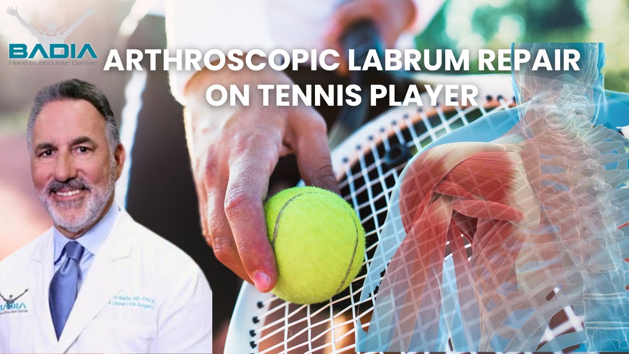 Dr. Badia explains Labrum repair to patient post-op #orthopedics # ...
