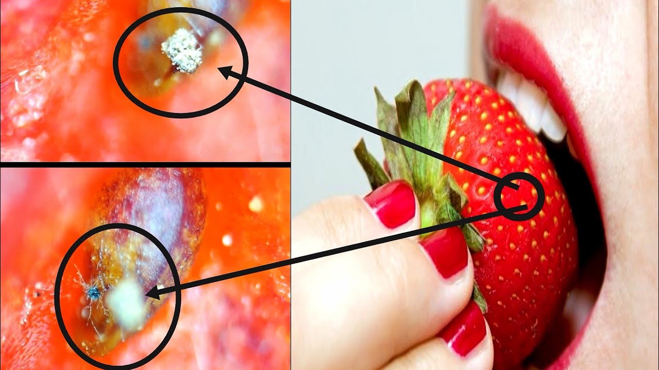 Strawberries Under The Microscope الفراولة تحت المجهر Microscope Food