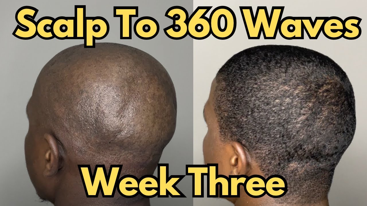 Scalp To 360 Waves - Week Three - YouTube