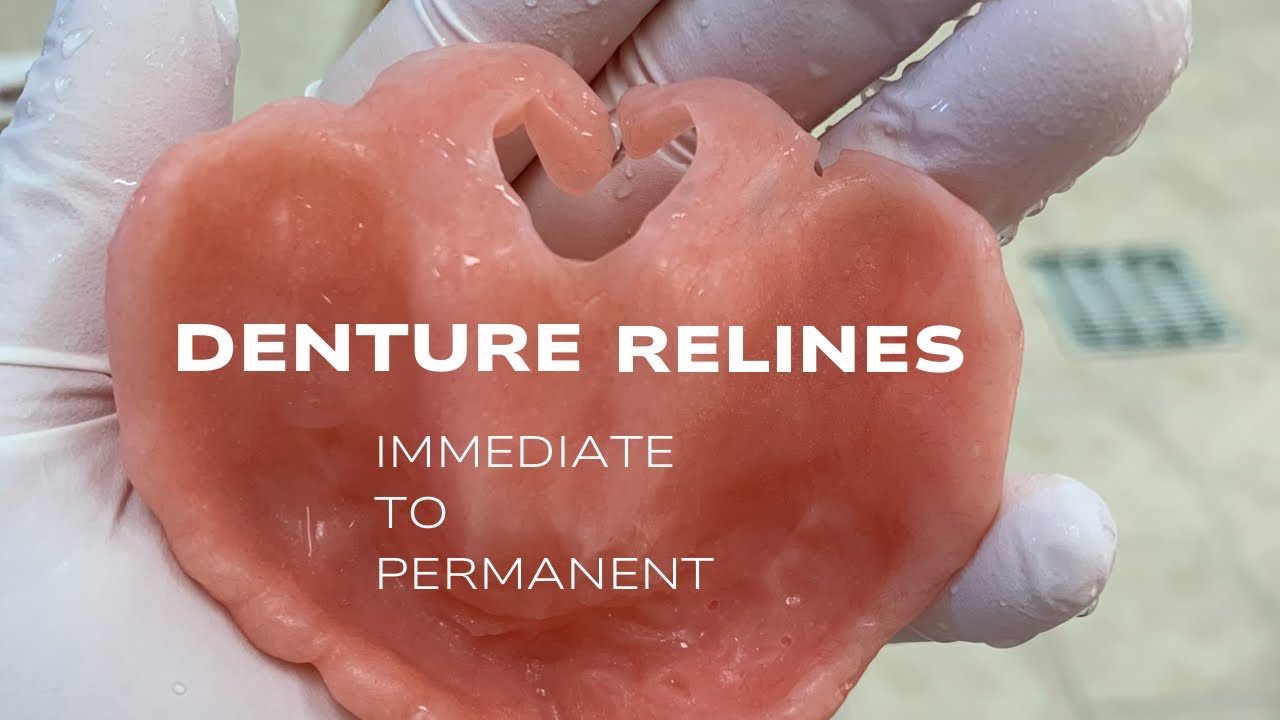 Immediate Denture/Permanent Reline - YouTube
