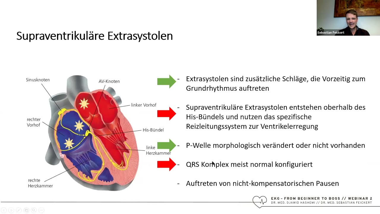 EKG - From Beginner To Boss | Teil 2 | (Supra-)ventrikuläre ...