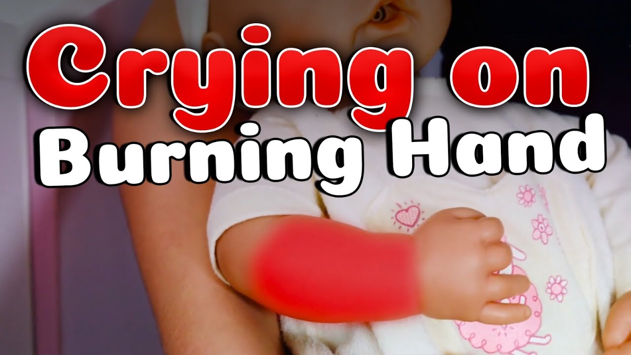 Baby Doll's hand hurts | Born Baby Crying On Burning Hand Annabell Doll ...