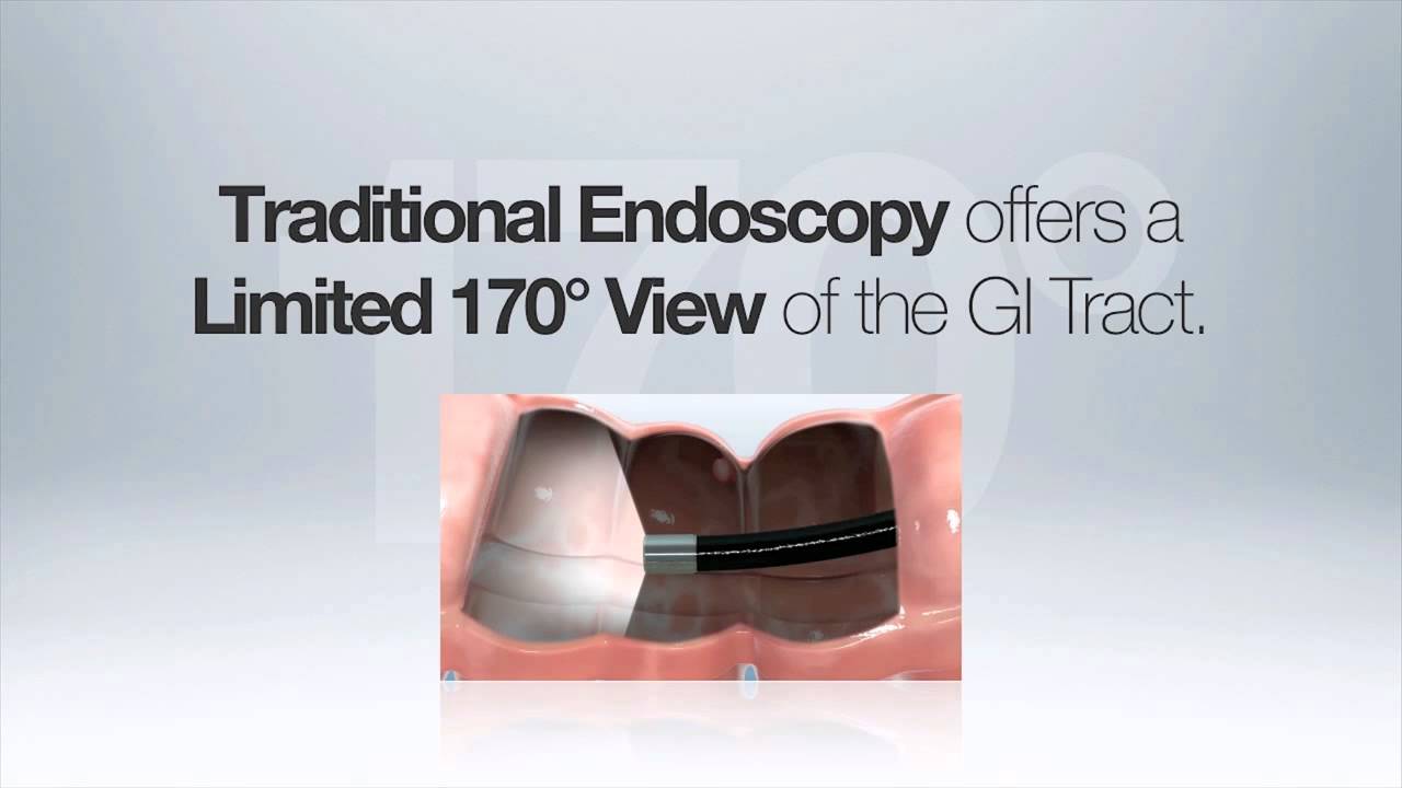 143 fuse™ full spectrum endoscopy system overview 1280x720 - YouTube