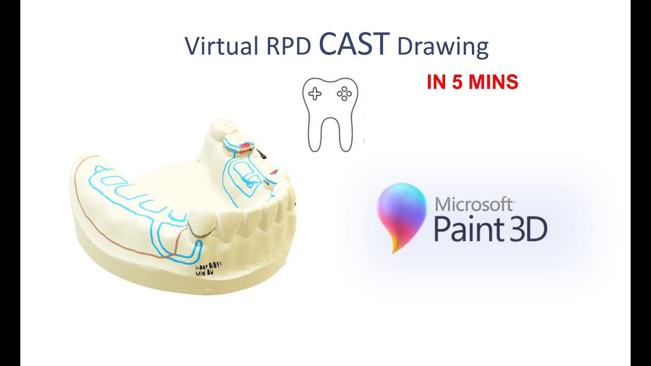 Virtual Cast RPD Drawing in 5 mins - YouTube