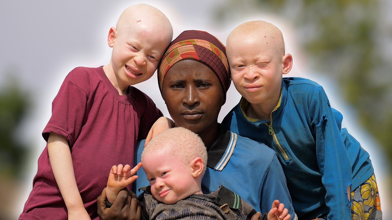 I Chose Die With My Albino Children : EXTRAORDINARY STORY - YouTube