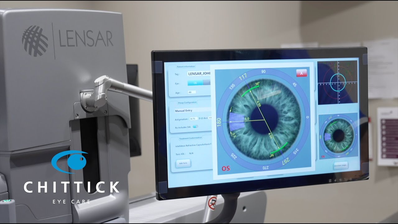 Chittick Ophthamology 30 sec TV - YouTube